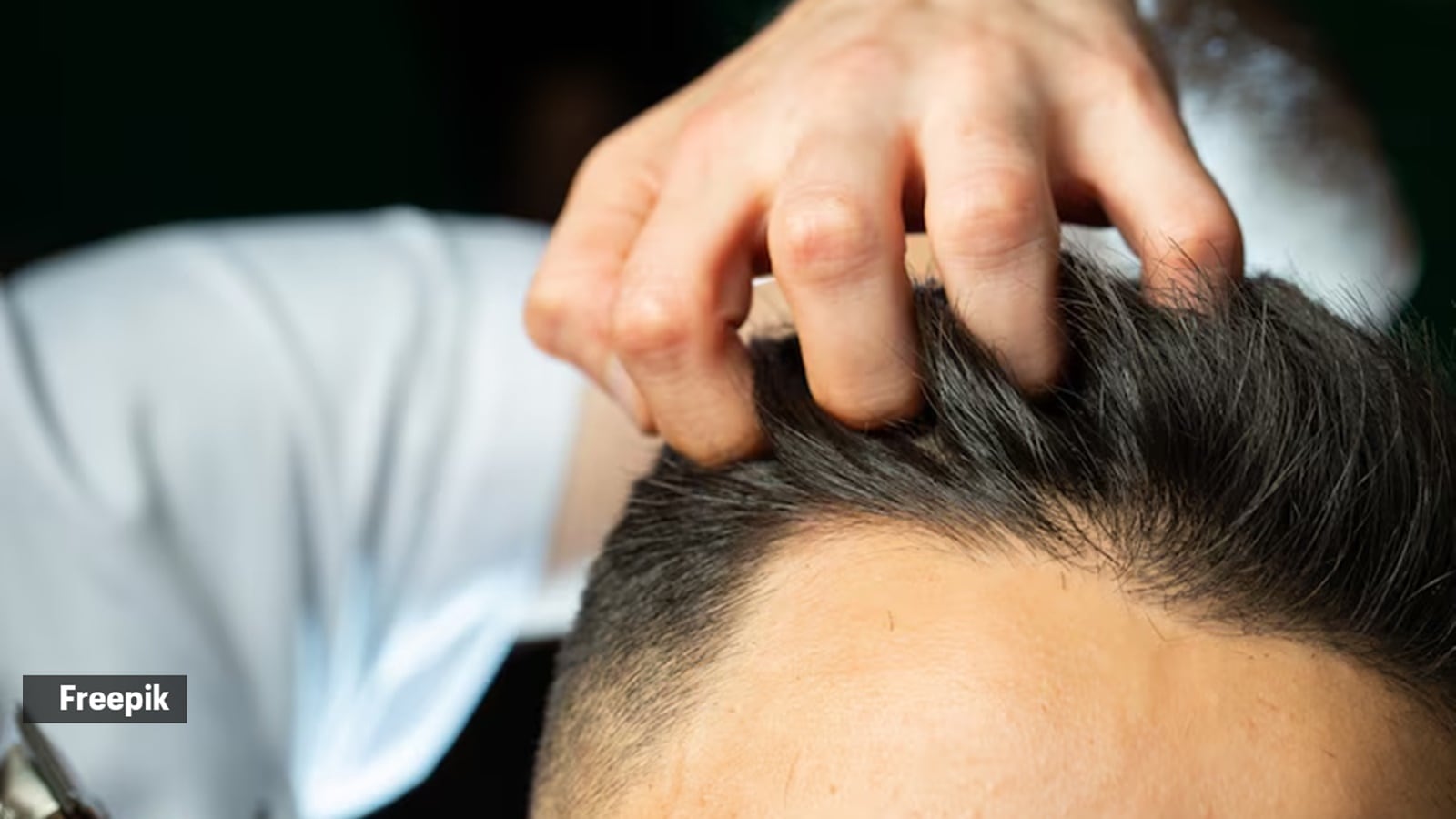 As the “Turkish hair” imitation goes viral, here is a closer look at ...